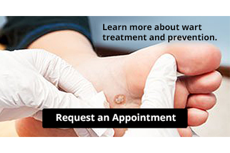 Plantar Warts Can Be Treated! - Family Foot & Ankle Centers